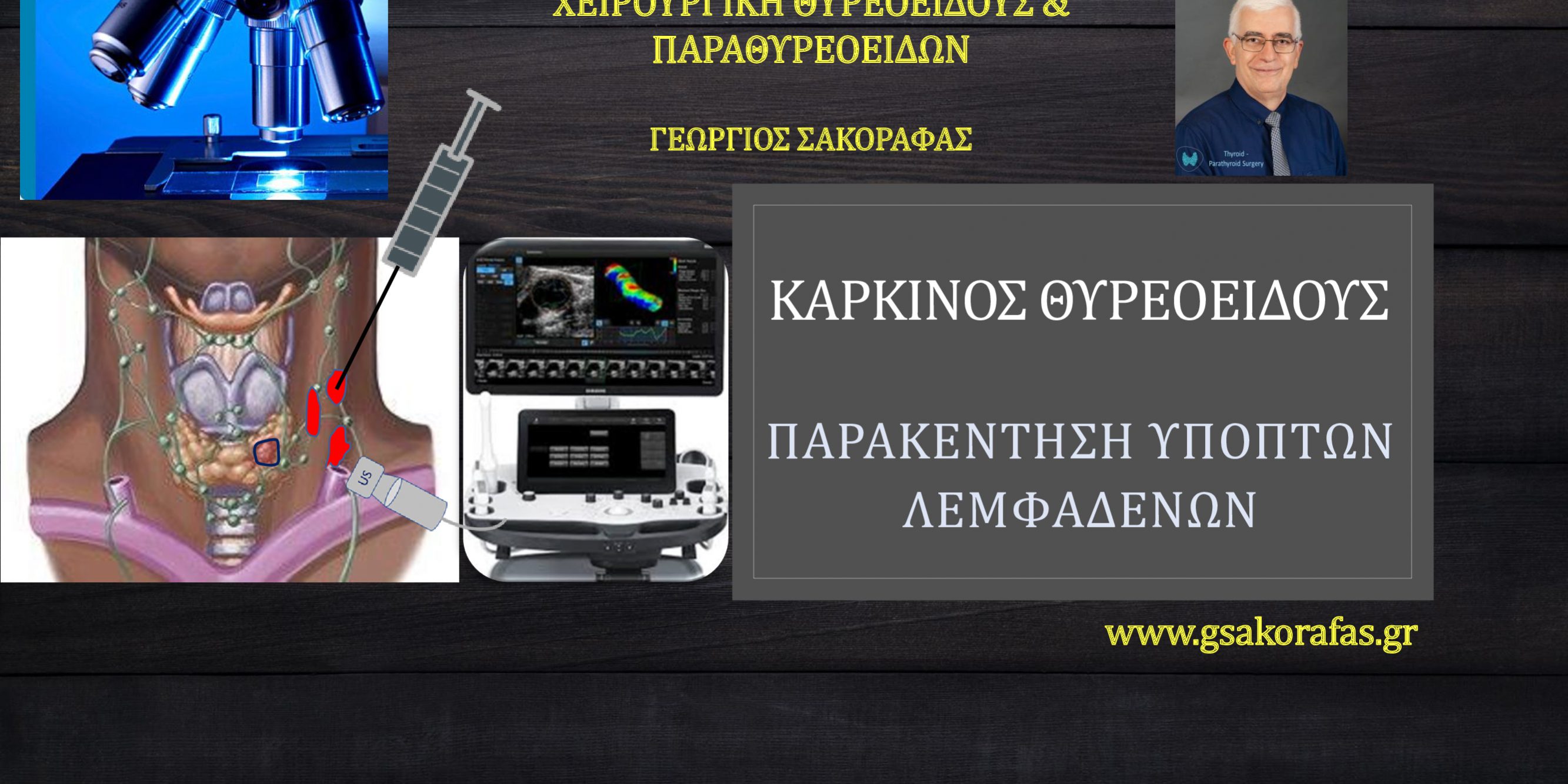 Καρκίνος θυρεοειδούς - Ο συχνότερος καρκίνος των ενδοκρινών αδένων ( 90 ...