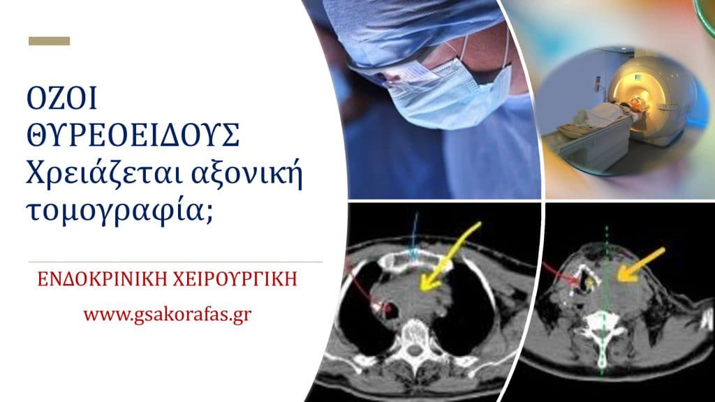 Όζοι θυρεοειδούς : χρειάζεται αξονική τομογραφία;