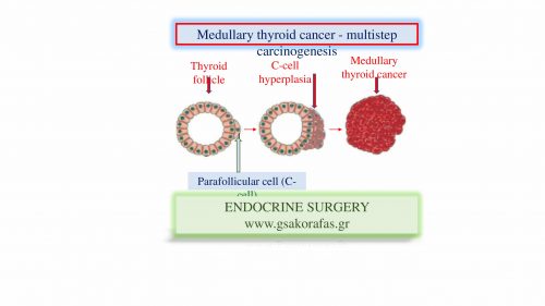 Incidentally discovered C-cell hyperplasia - practical significance