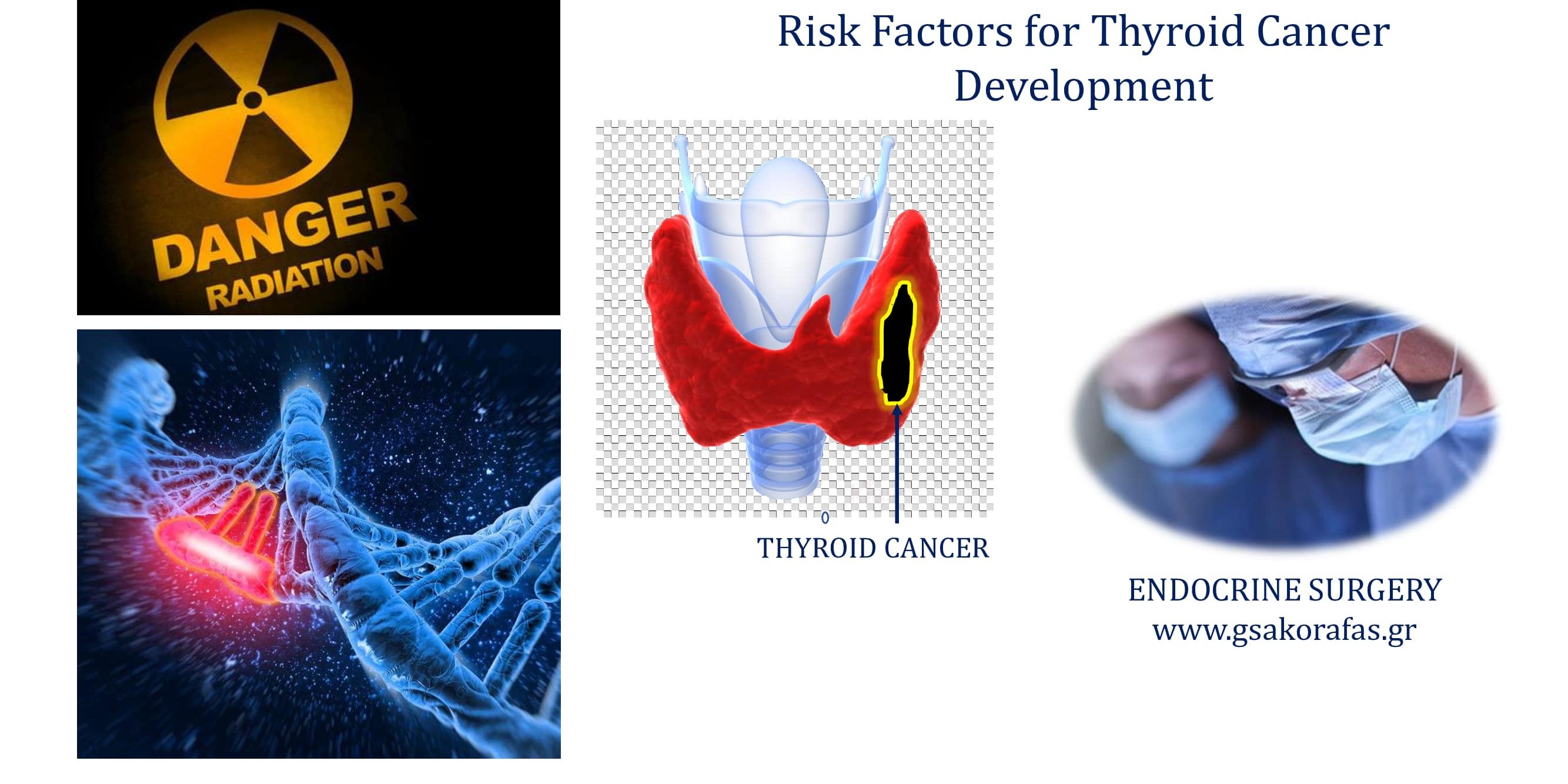 Thyroid cancer - Risk Factors: clinical significance / practical ...