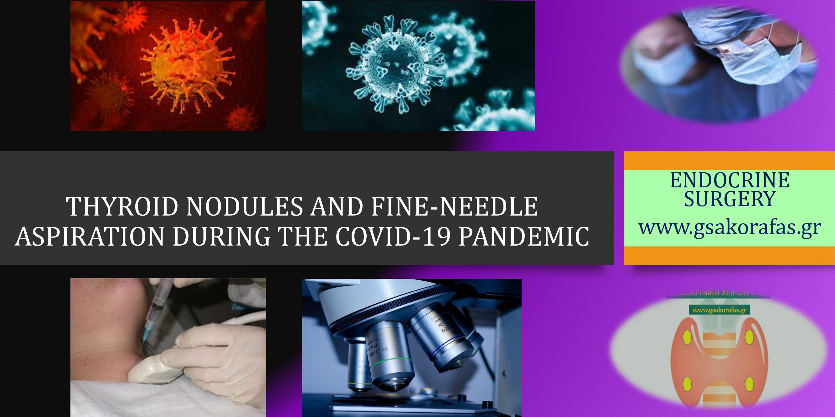Thyroid nodule:TI-RADS classification based on ultrasonographic findings