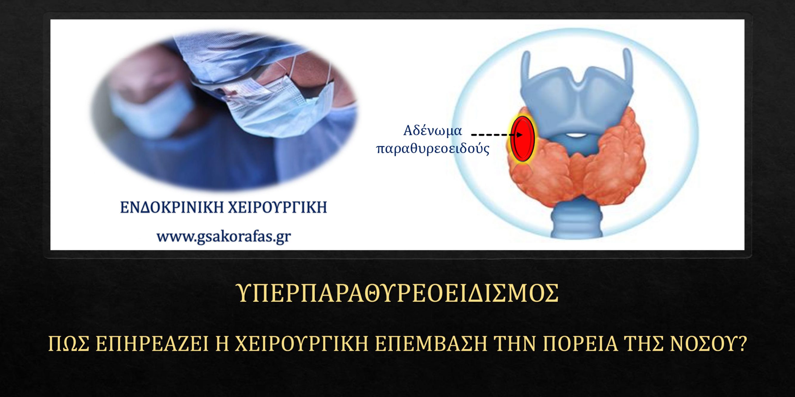 Υπερπαραθυρεοειδισμός, παραθυρεοειδεκτομή-πορεία νόσου9