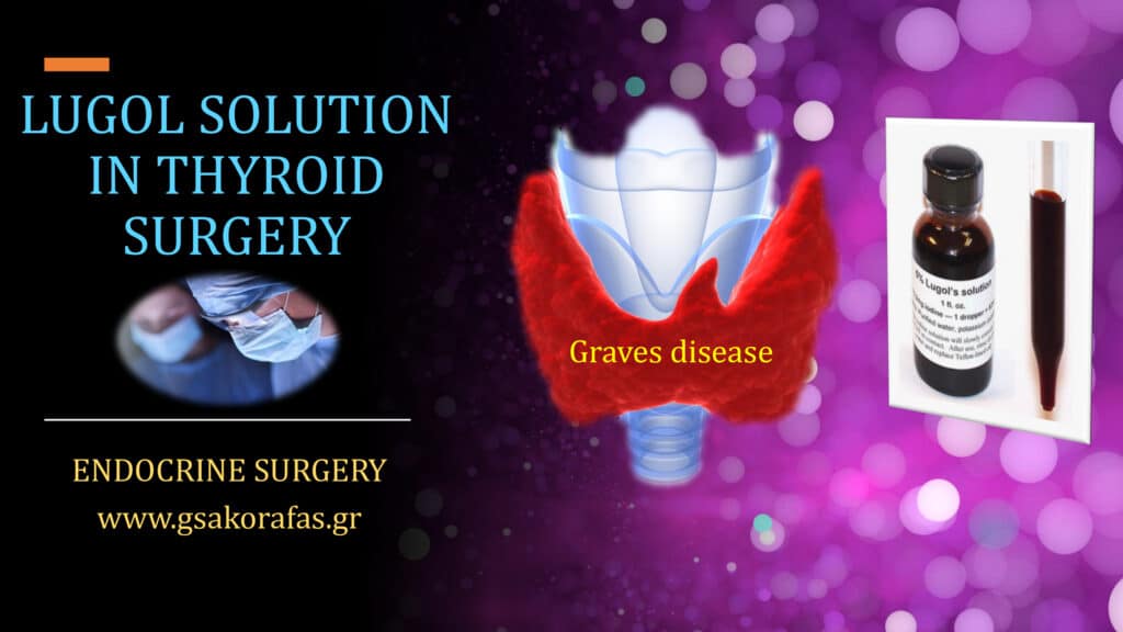 Lugol solution in thyroid surgery - clinical utility906