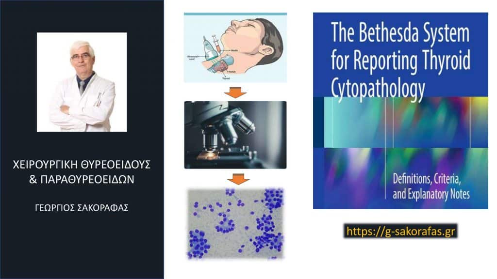Όζος θυρεοειδούς και παρακέντηση (FNA)-σύστημα Bethesda