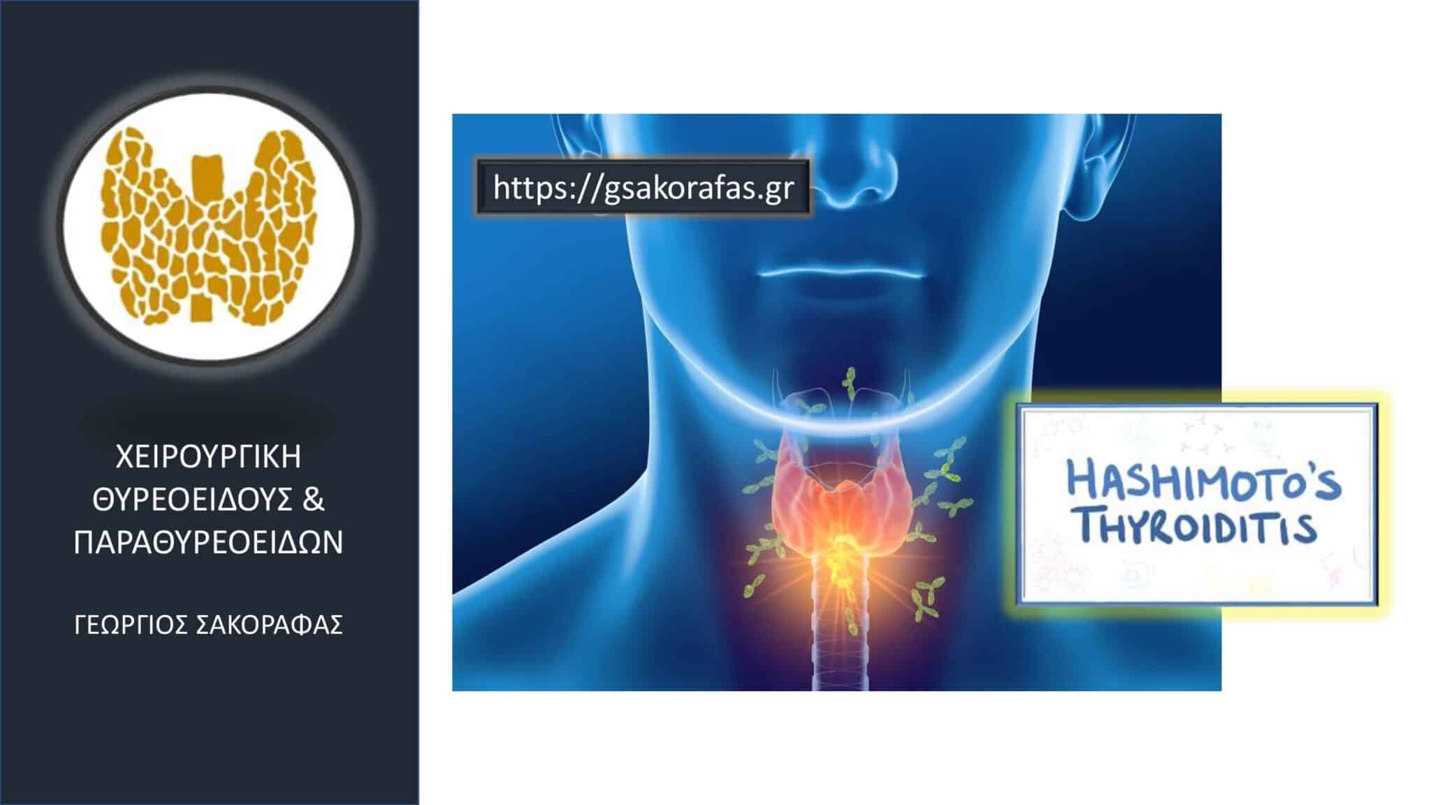 Θυρεοειδίτιδα- Μορφές φλεγμονής του θυρεοειδή αδένα