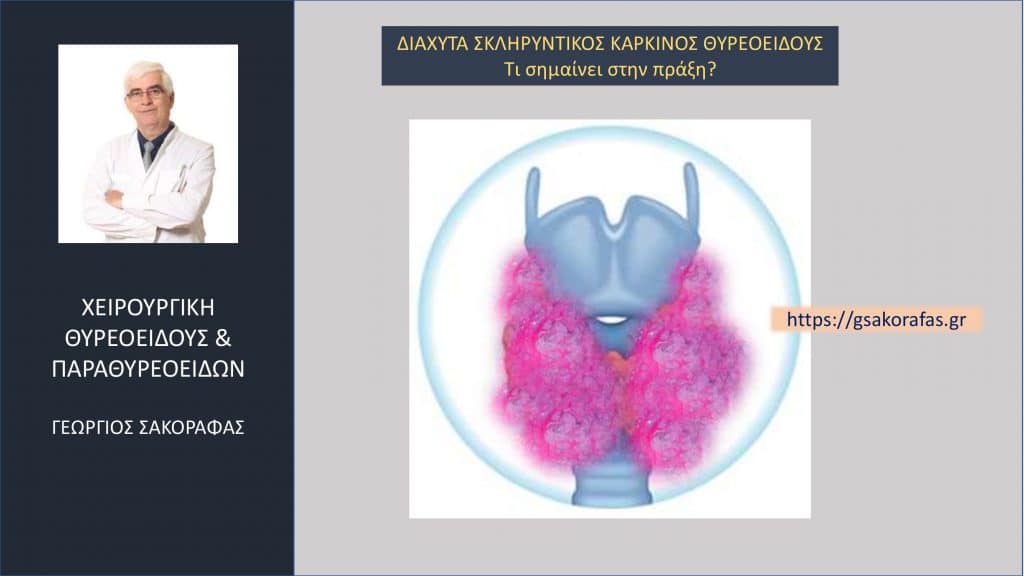 Διάχυτα σκληρυντικός καρκίνος θυρεοειδούς-Θυρεοειδεκτομή 9
