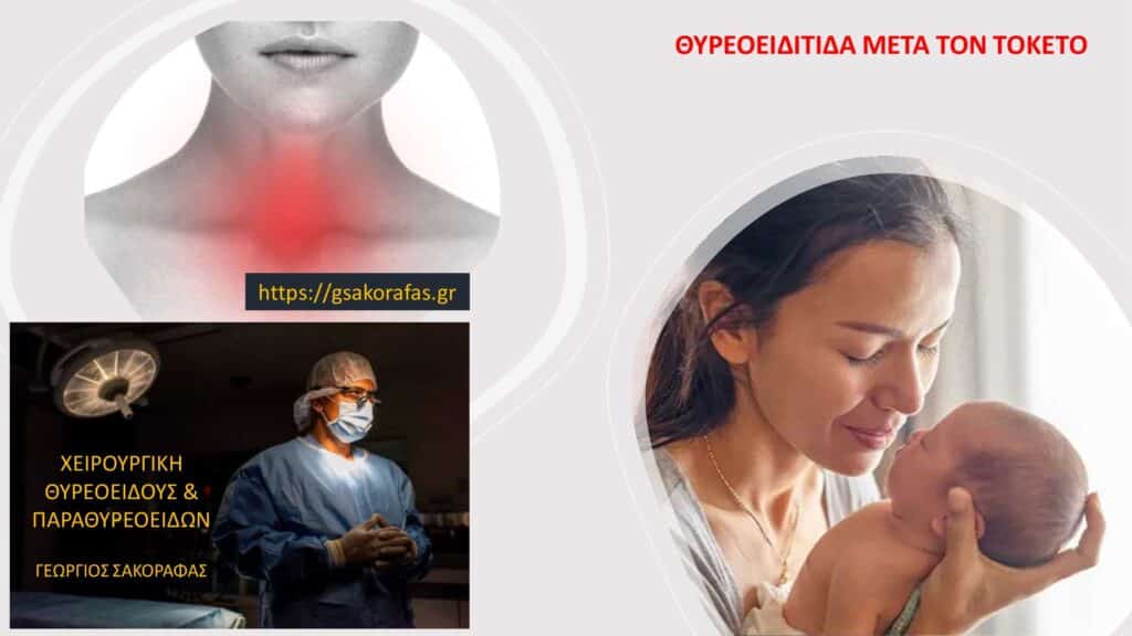 Θυρεοειδίτιδα μετά τον τοκετό-διάγνωση και θεραπεία3