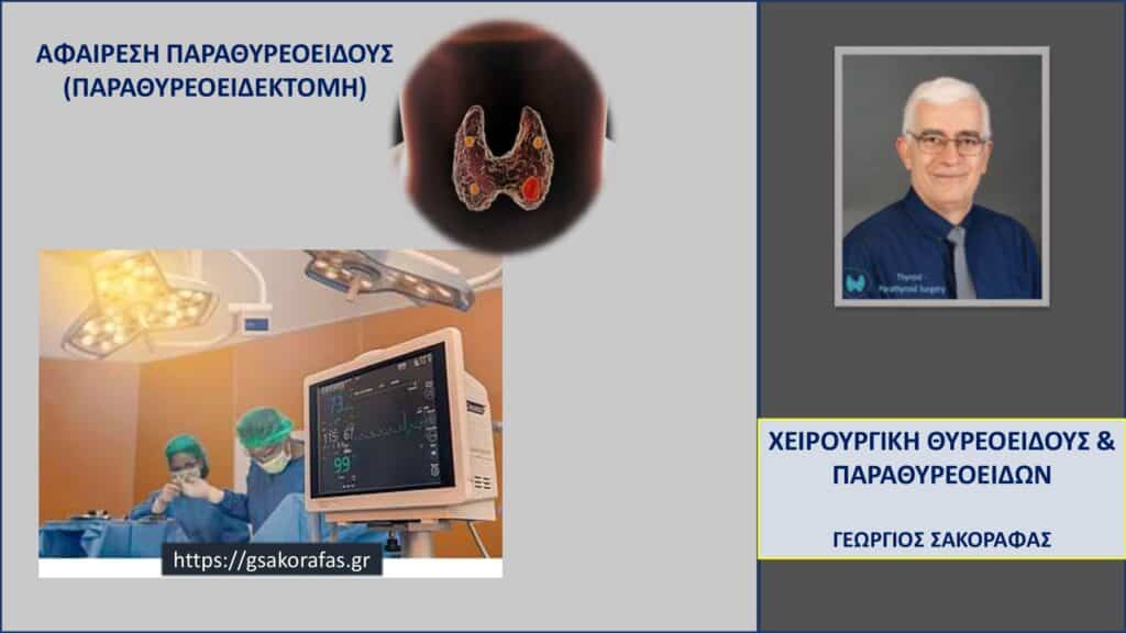 Αφαίρεση παραθυρεοειδούς - παραθυρεοειδεκτομή 8 6 5 4