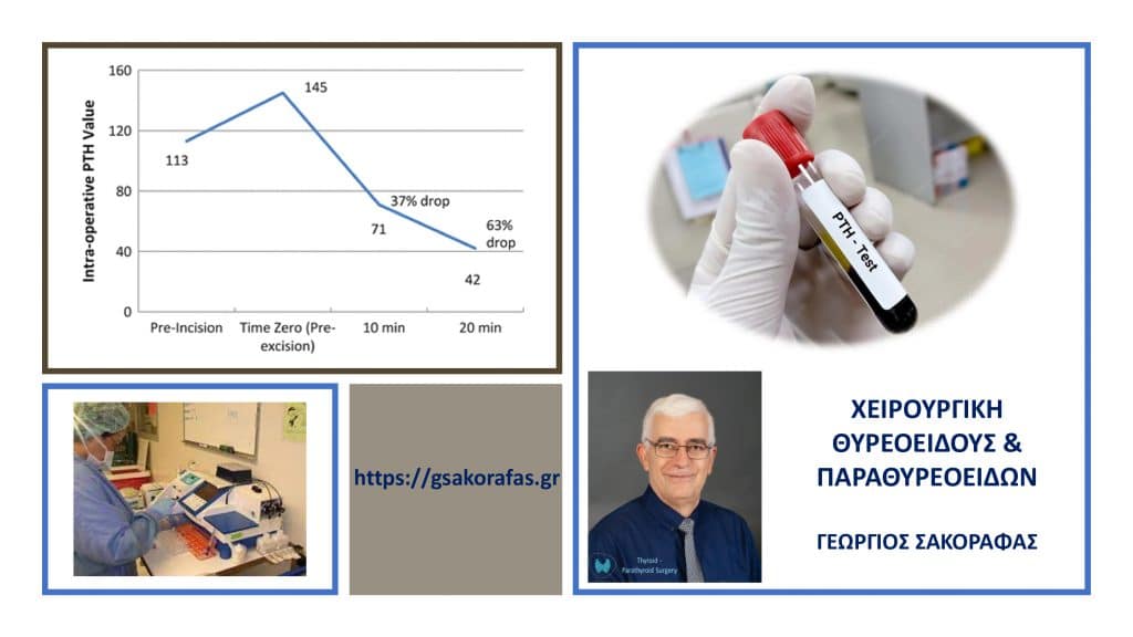 Διεγχειρητική μέτρηση παραθορμόνης και παραθυρεοειδεκτομή5