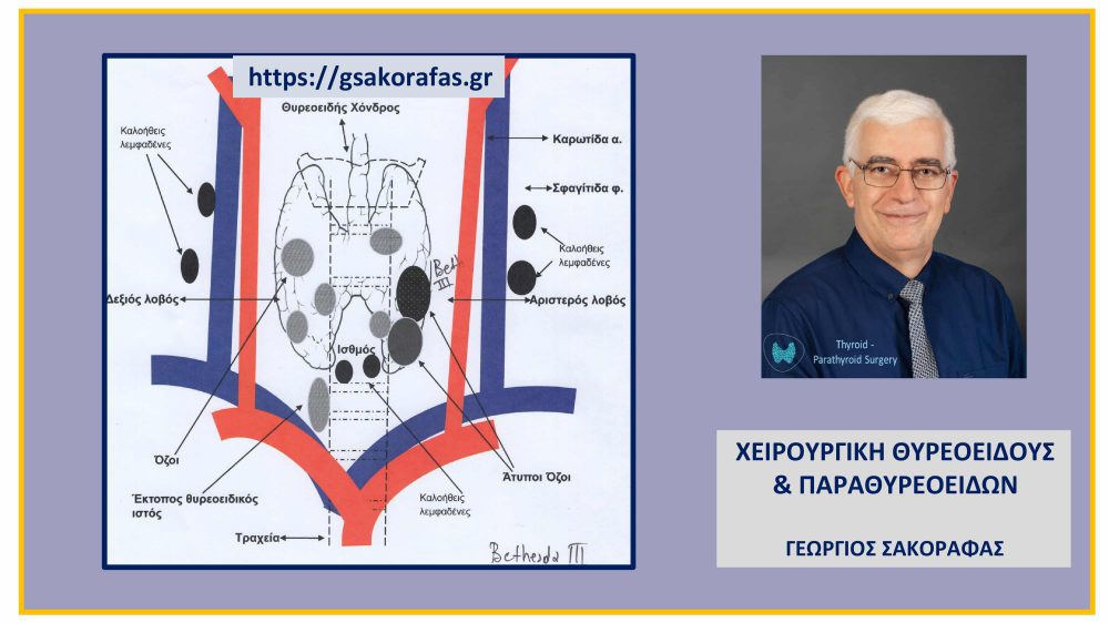 Έκτοπος θυρεοειδής (θυρεοειδικός ιστός) σε ασθενή μας 49 ετών