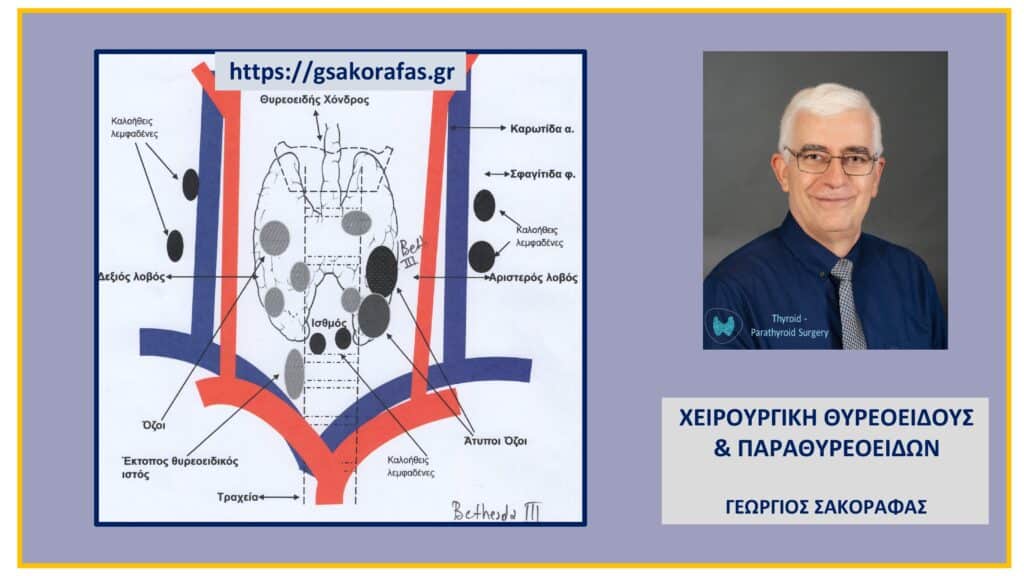 Έκτοπος θυρεοειδής (θυρεοειδικός ιστός) σε ασθενή μας 49 ετών