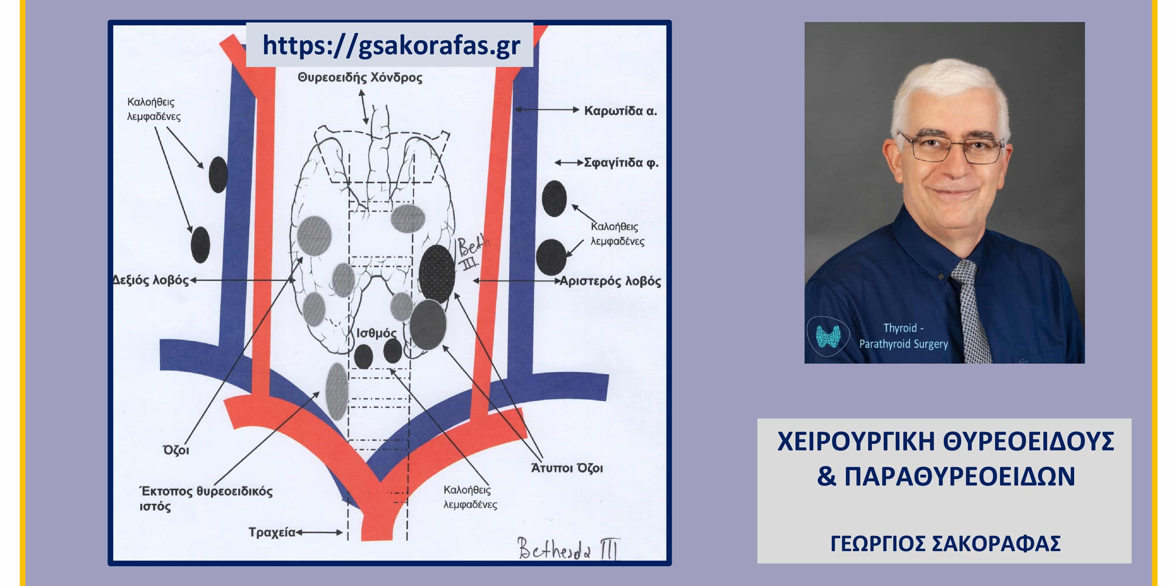 Έκτοπος θυρεοειδής (θυρεοειδικός ιστός) σε ασθενή μας 49 ετών