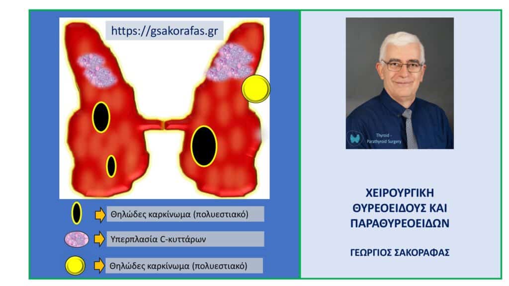 Καρκίνος θυρεοειδούς - τριπλή παθολογία στον ίδιο ασθενή, ετών 76