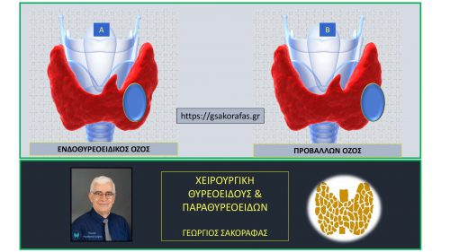 Όζοι θυρεοειδούς και πρότυπο ανάπτυξης - ταξινόμηση