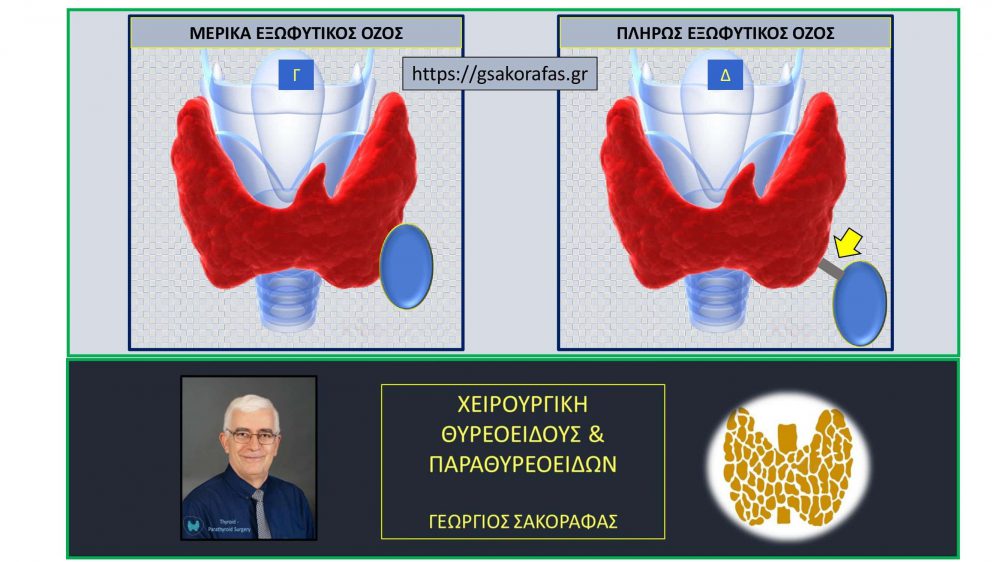 Όζοι θυρεοειδούς και πρότυπο ανάπτυξης - ταξινόμηση