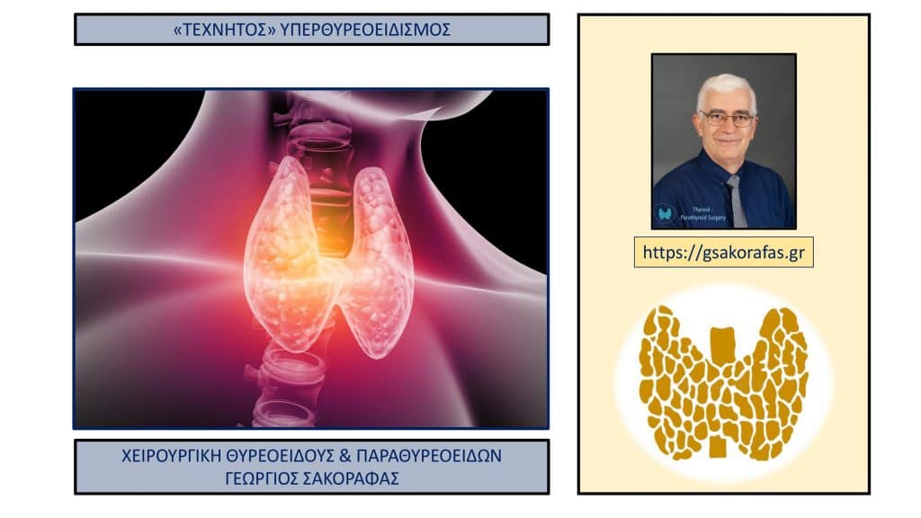 Τεχνητός υπερθυρεοειδισμός-αιτιολογία-διάγνωση-αντιμετώπιση