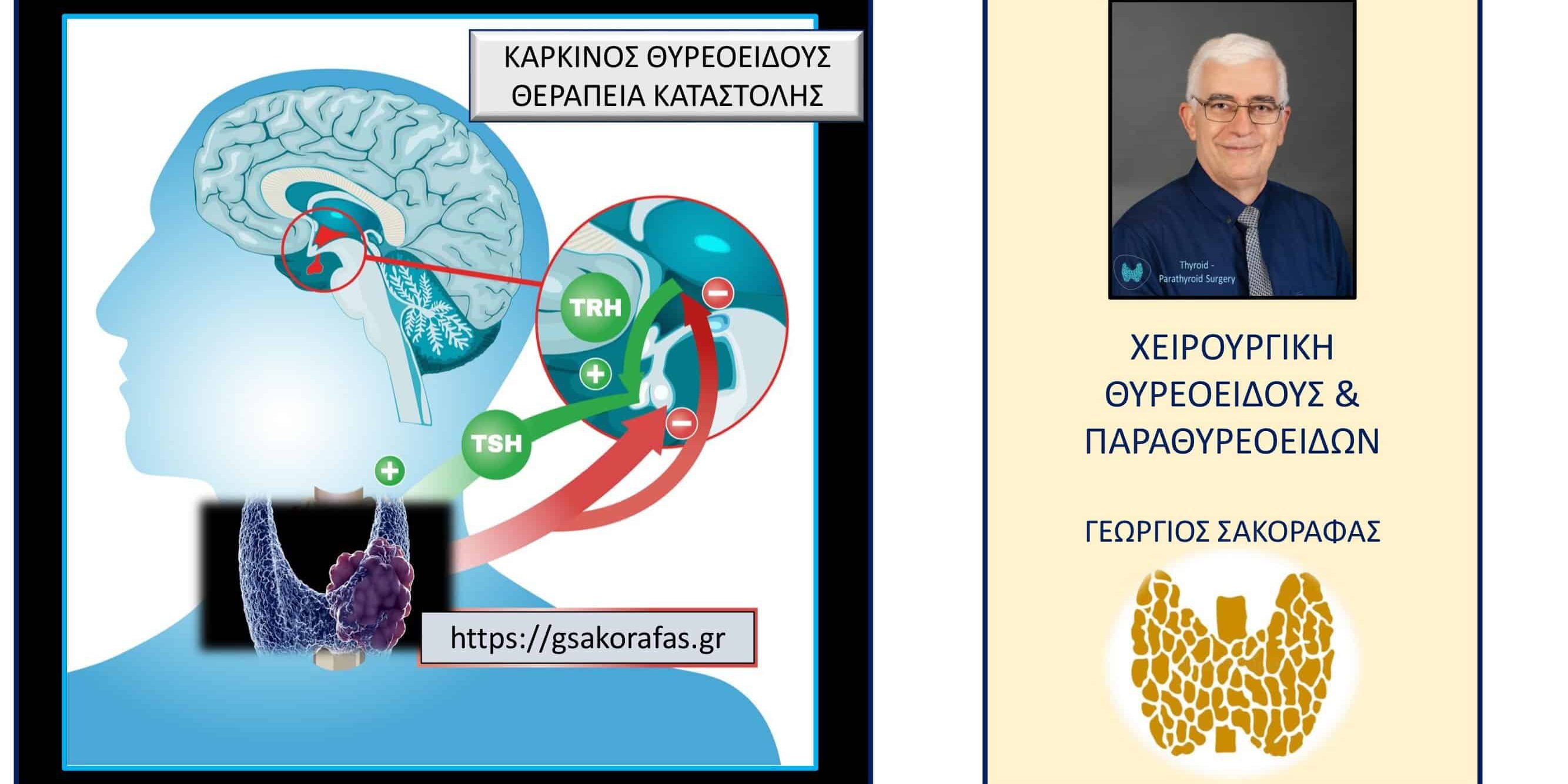 Θυρεοειδεκτομή και θυροξίνη – θεραπεία καταστολής