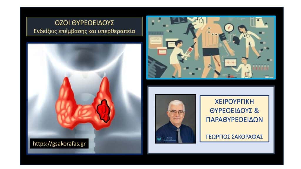 Όζοι θυρεοειδούς και θυρεοειδεκτομή - ενδείξεις επέμβασης