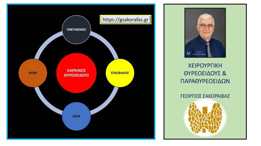 Καρκίνος θυρεοειδούς μεταστάσεις μακρινές-αντιμετώπιση