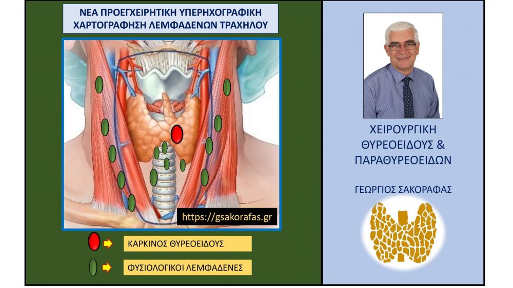 Καρκίνος θυρεοειδούς προβληματισμοί -σε ασθενή μας 28 ετών