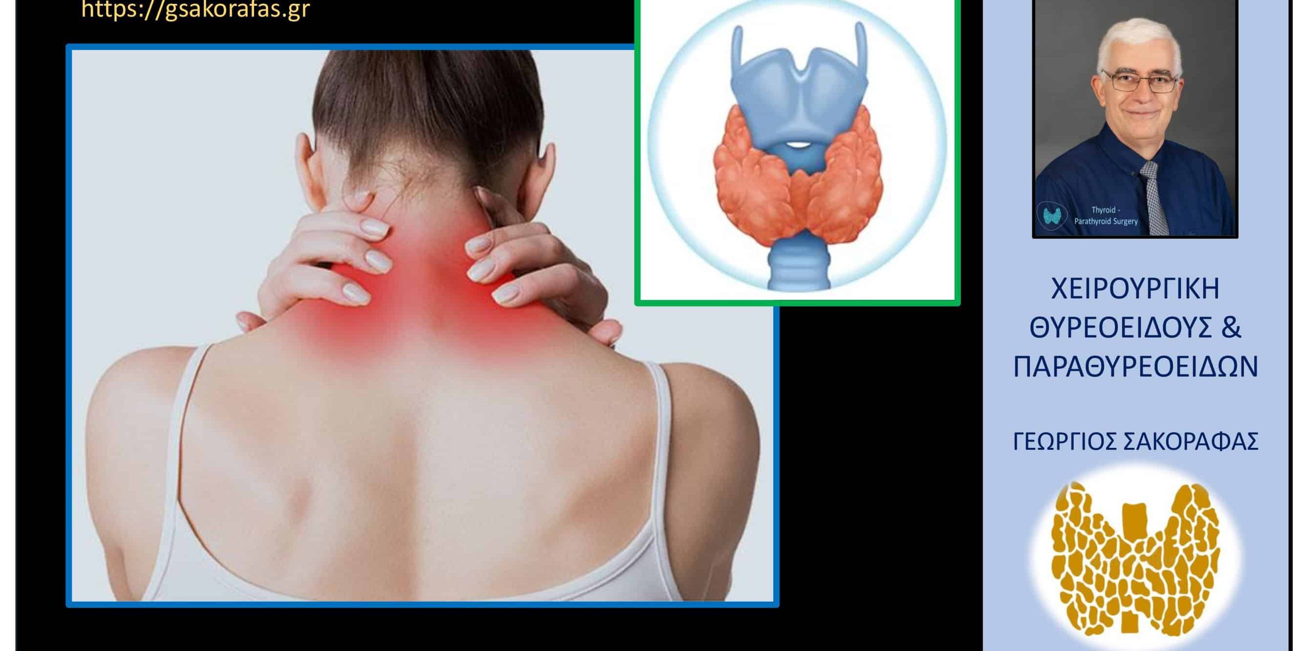 Θυρεοειδεκτομή και αυχεναλγία - 4 ασκήσεις αποκατάστασης