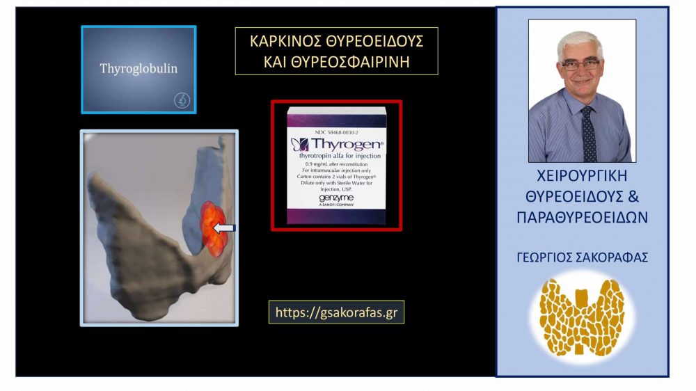 Θυρεοσφαιρίνη καρκίνος θυρεοειδούς (βασική-με διέγερση)