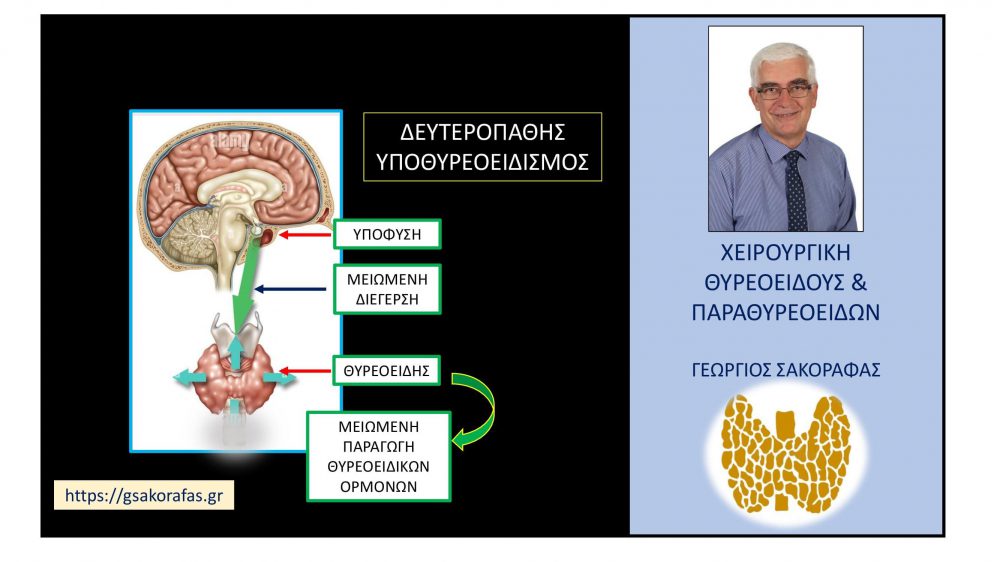 Δευτεροπαθής υποθυρεοειδισμός - αιτιολογία και 17 εκδηλώσεις