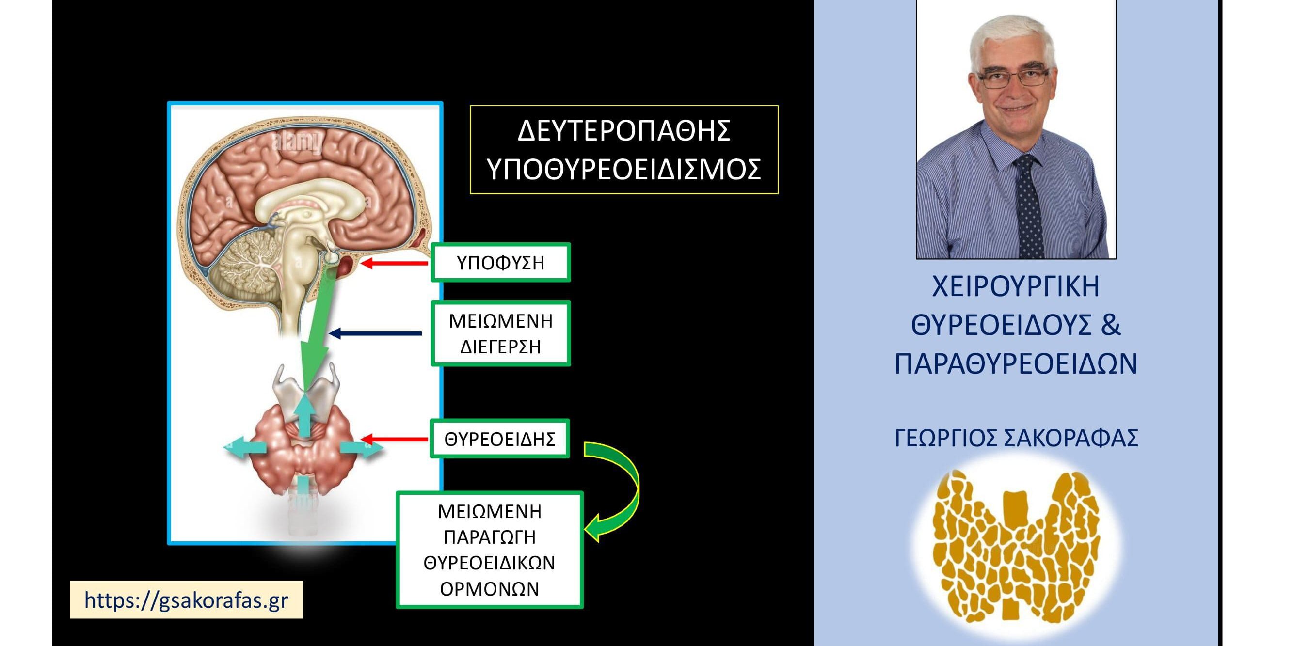 Δευτεροπαθής υποθυρεοειδισμός - αιτιολογία και 17 εκδηλώσεις