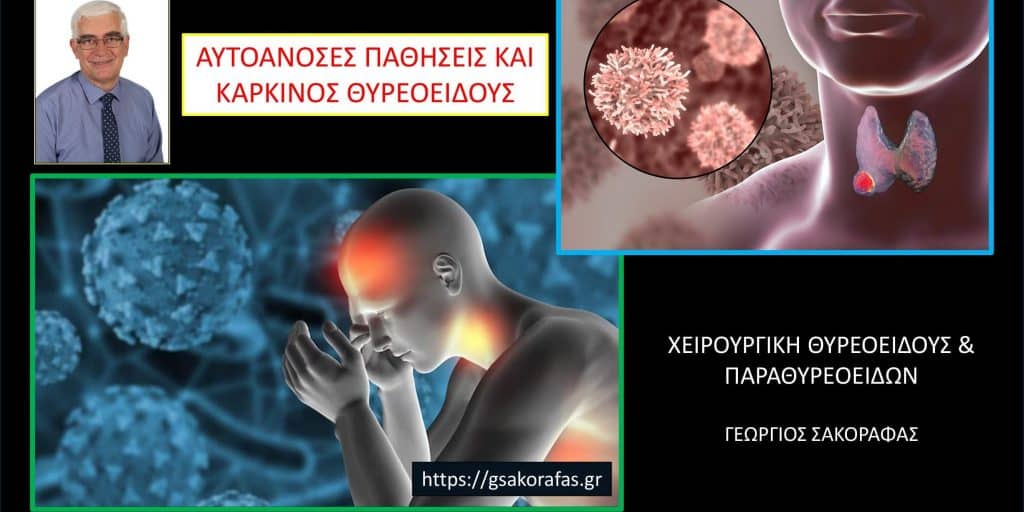 Καρκίνος θυρεοειδούς και αυτοάνοσες παθήσεις
