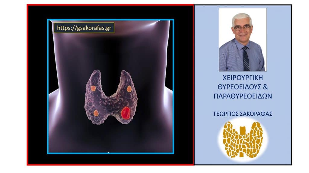 Υπερπαραθυρεοειδισμός-υποδιάγνωση (και οι συνέπειές της) 51