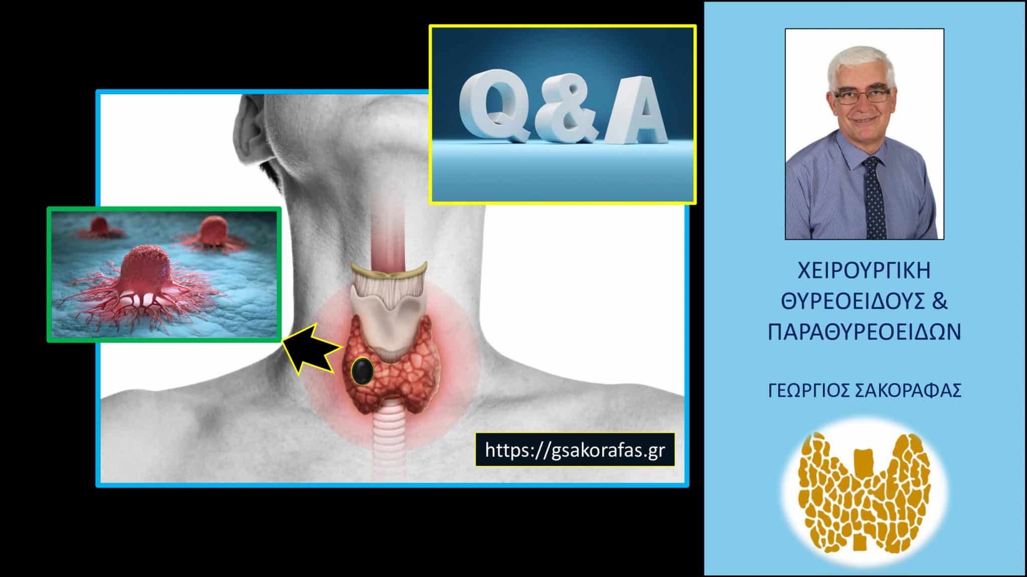 Καρκίνος θυρεοειδούς ερωτήσεις που πρέπει να απαντηθούν