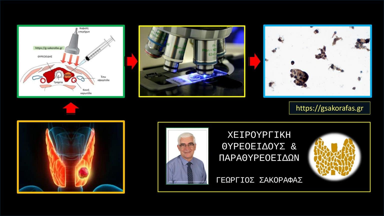Χειρουργός Θυρεοειδούς Σακοράφας Γεώργιος, Αθήνα