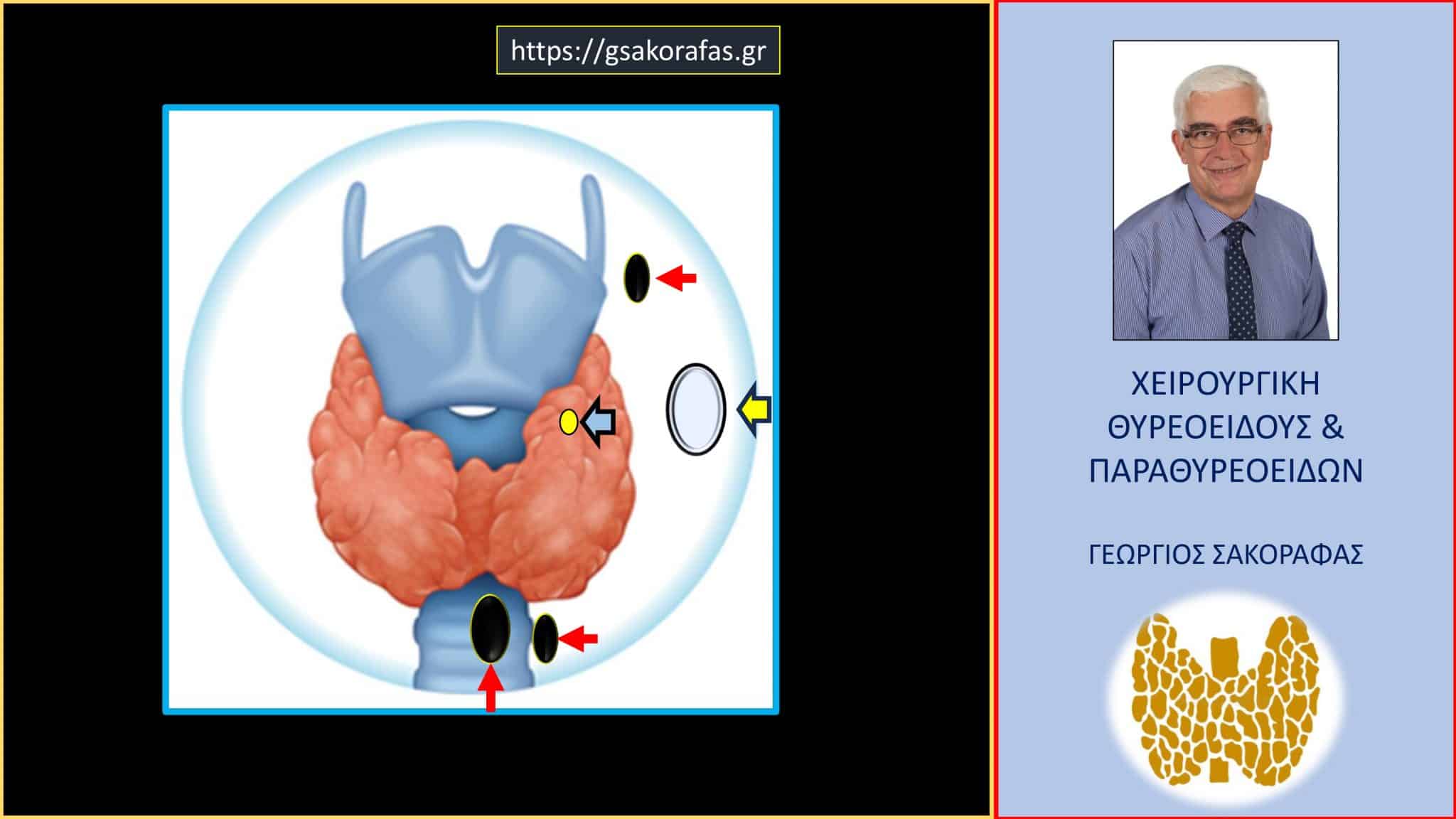 Καρκίνος θυρεοειδούς – μία διαγνωστική «παγίδα» 8 5 3