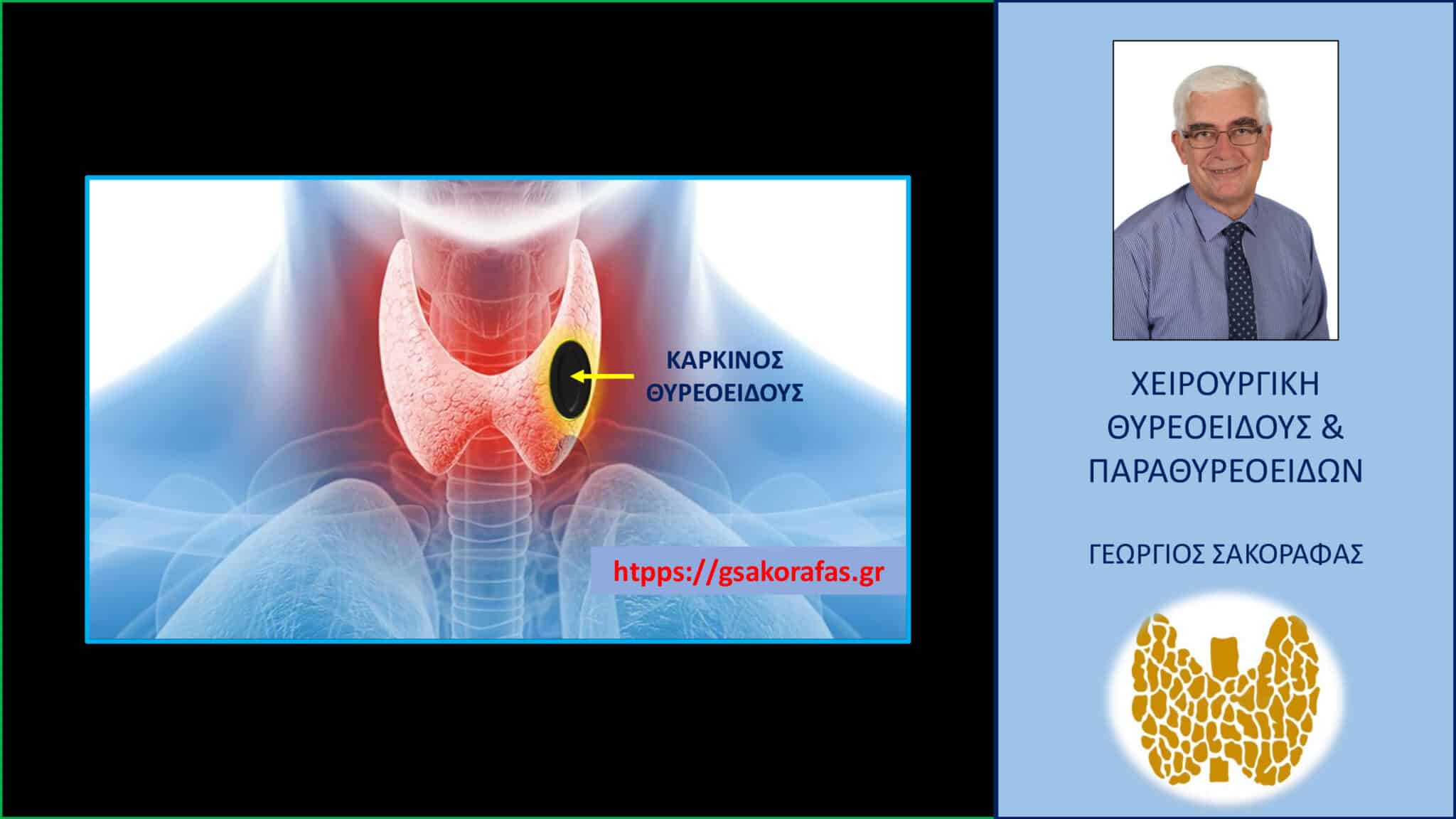Χειρουργός Θυρεοειδούς Σακοράφας Γεώργιος, Αθήνα