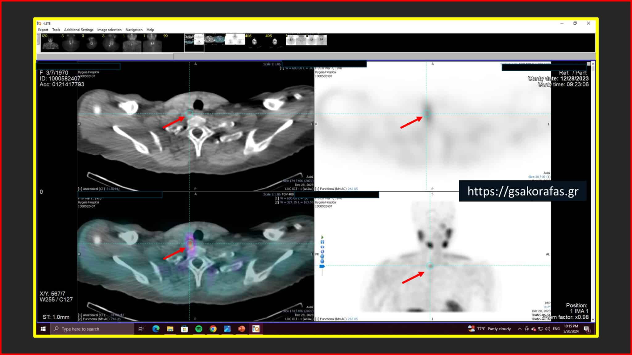 Χειρουργός Θυρεοειδούς Σακοράφας Γεώργιος, Αθήνα