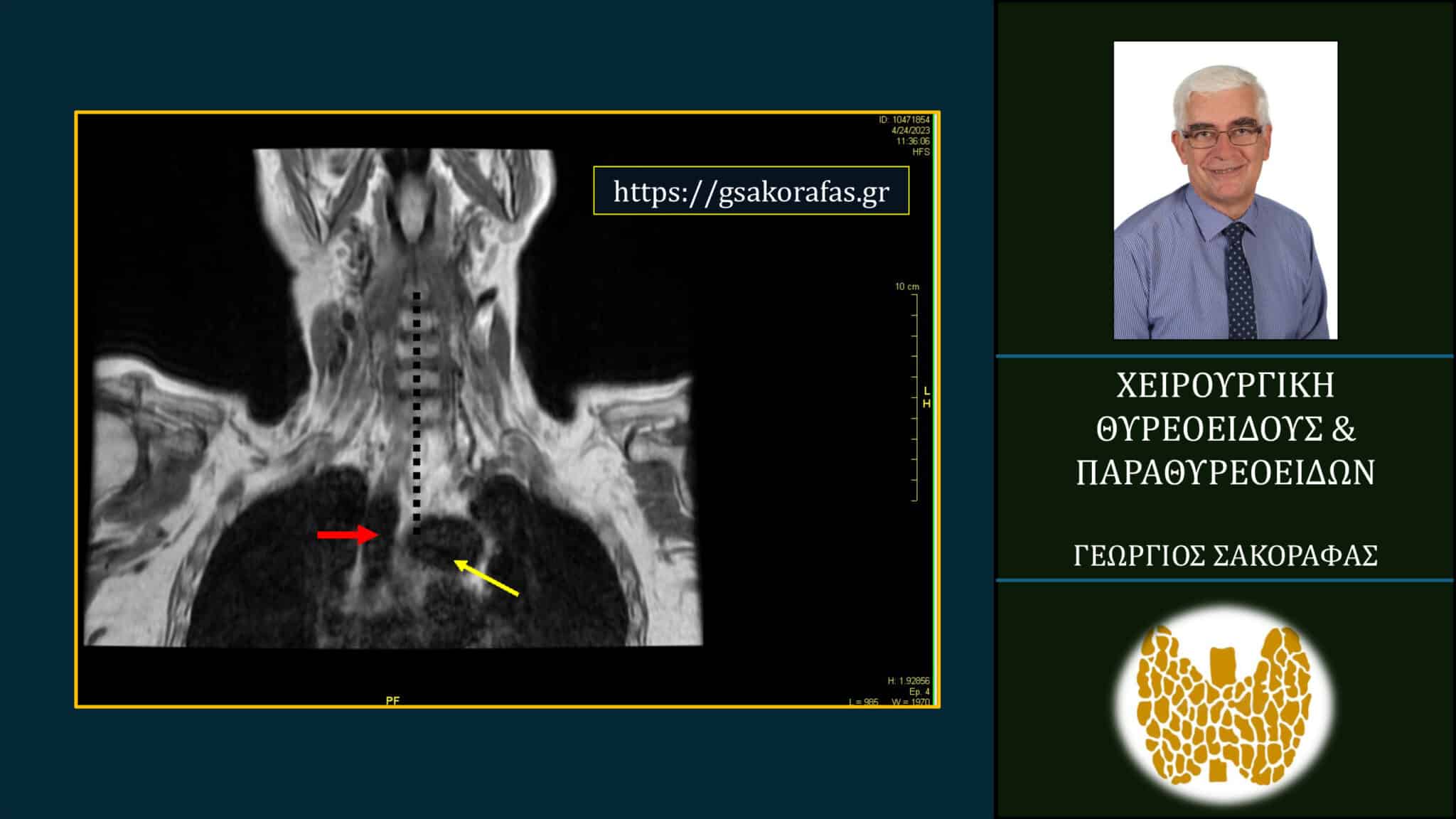Χειρουργός Θυρεοειδούς Σακοράφας Γεώργιος, Αθήνα
