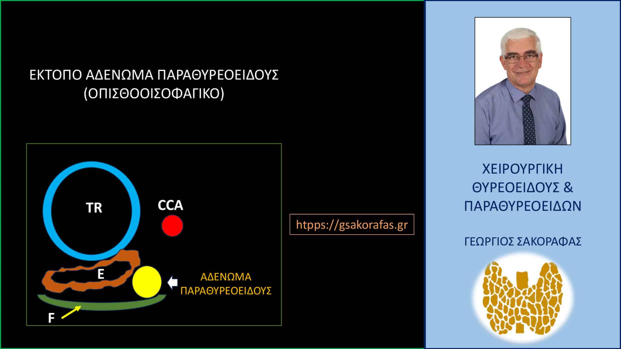 Χειρουργός Θυρεοειδούς Σακοράφας Γεώργιος, Αθήνα