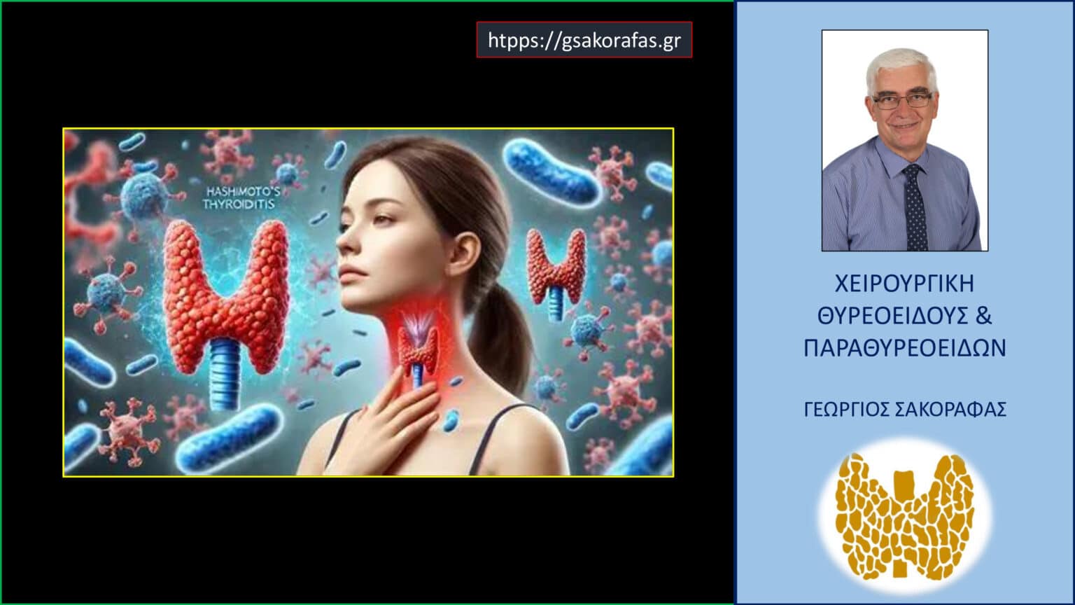 Θυρεοειδίτιδα Hashimoto - γιατί είναι τόσο συχνή?1